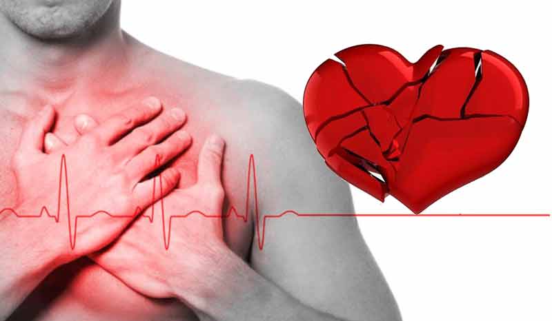 Síndrome del corazón roto se asimila a un ataque cardíaco - Dominicano ...